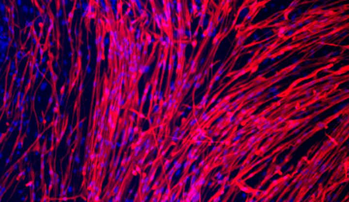 Myotubes differentiated from a [IMAGE] | EurekAlert! Science News Releases