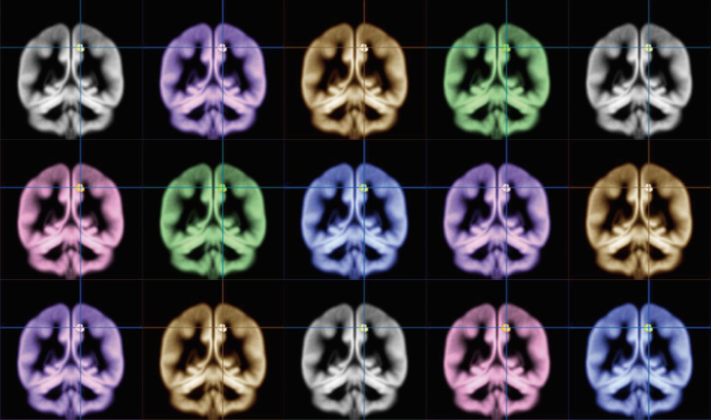 MRI Scans Show Happiness in th [IMAGE] | EurekAlert! Science News Releases