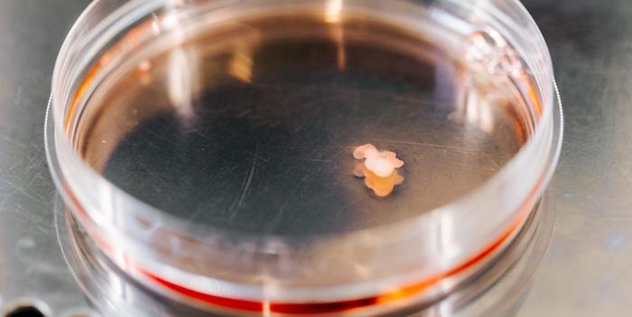 Growing mini brains to save li [IMAGE] | EurekAlert! Science News Releases