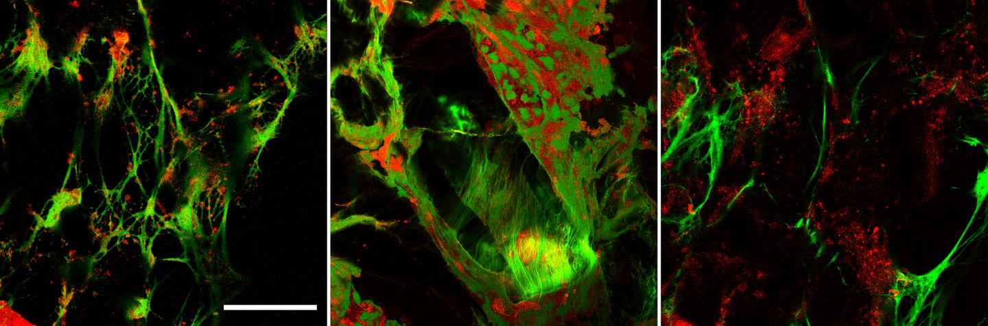Neutrophil Extracellular Traps [IMAGE] | EurekAlert! Science News Releases