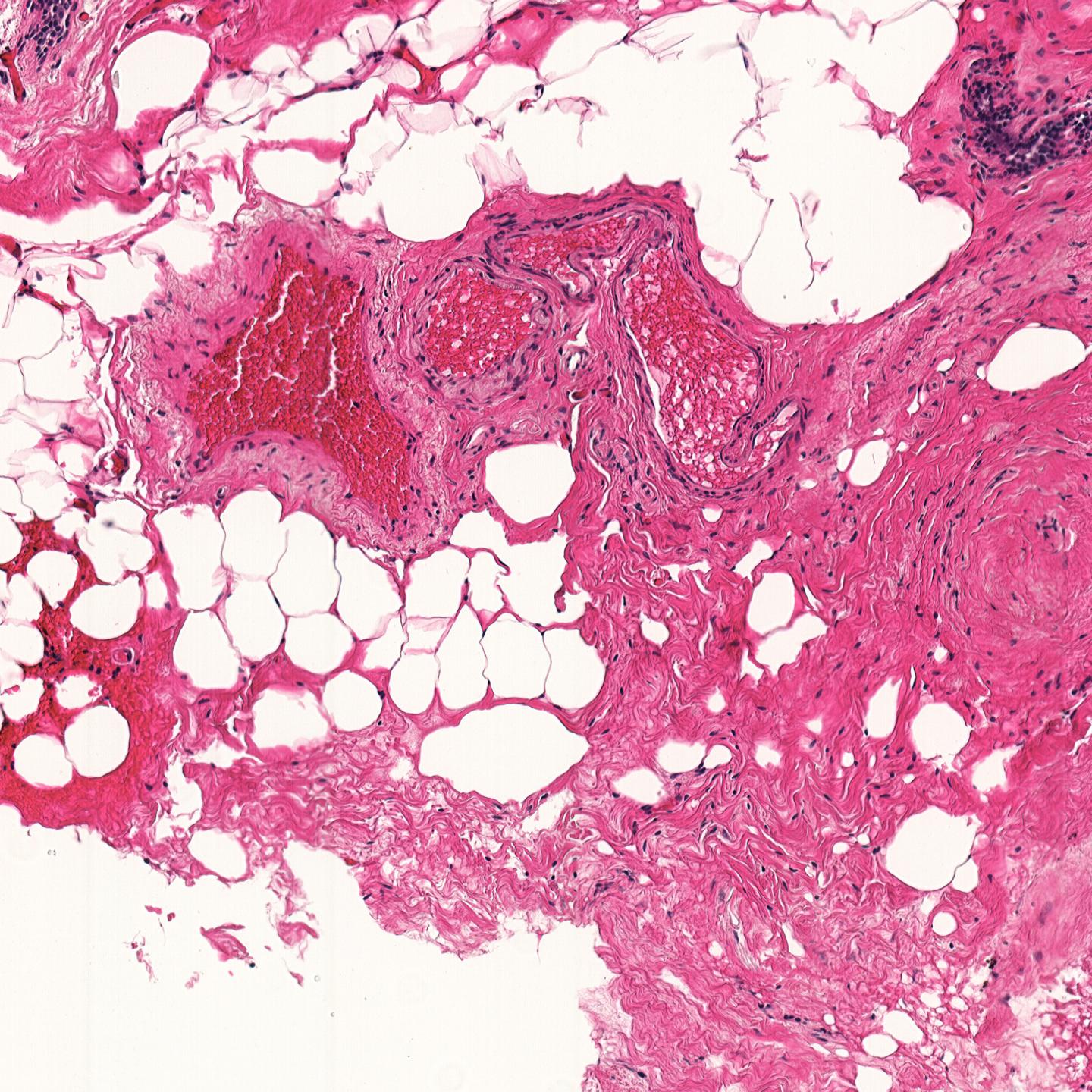 A Tissue Sample Viewed under a [IMAGE] | EurekAlert! Science News Releases
