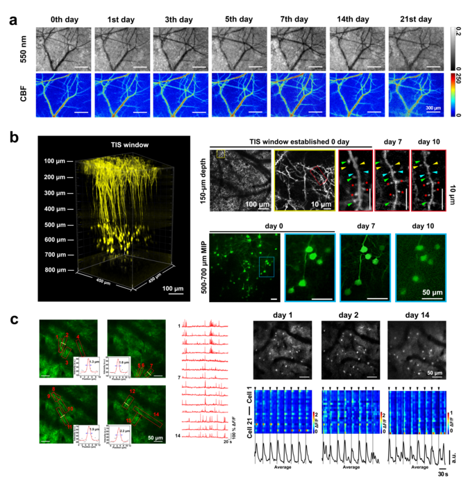 Cortical neurovascular imaging [IMAGE] | EurekAlert! Science News Releases