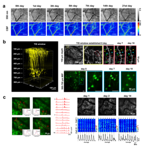 New approach to brain imaging leaves skulls i | EurekAlert!