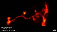 Researchers capture first 3D super-resolution | EurekAlert!