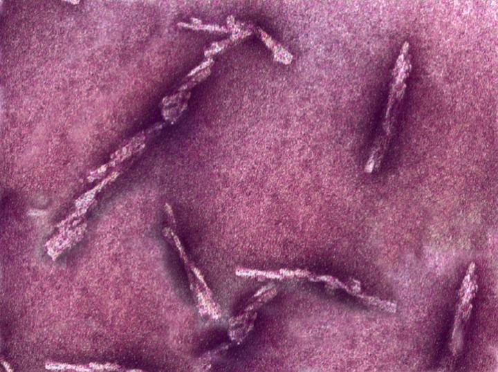 Prions [IMAGE] | EurekAlert! Science News Releases