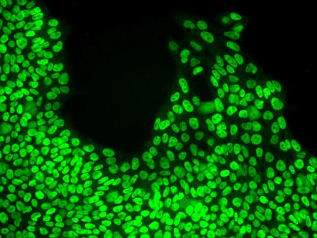 Stem Cells Suitable for Clinic [IMAGE] | EurekAlert! Science News Releases