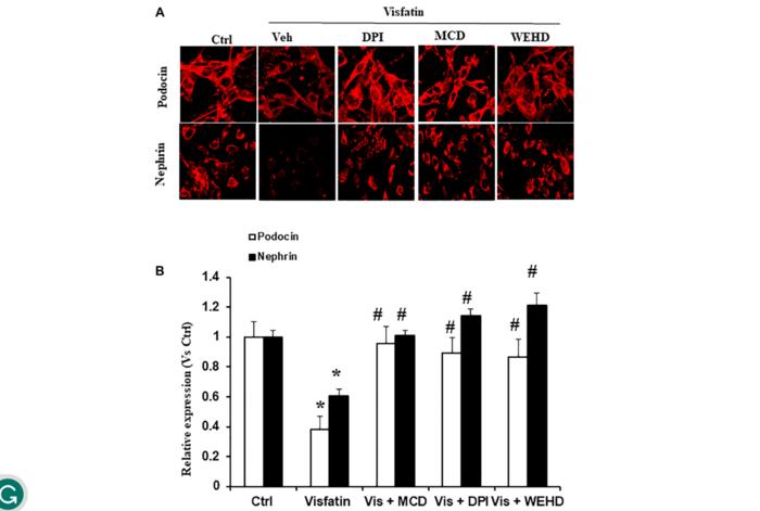 Figure 4 [IMAGE] | EurekAlert! Science News Releases