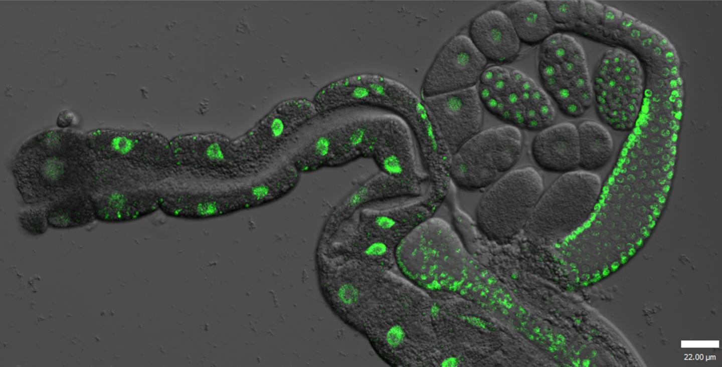 Young Adult Worm [IMAGE] | EurekAlert! Science News Releases