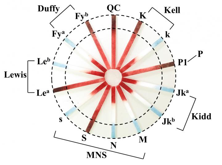 Fast and Accurate Paper Test Determines Blood | EurekAlert!