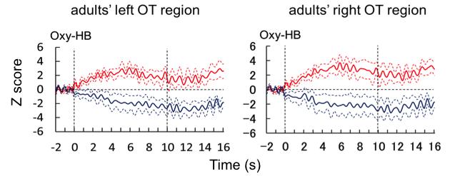 Time Course of Brain Activity, [IMAGE] | EurekAlert! Science News Releases