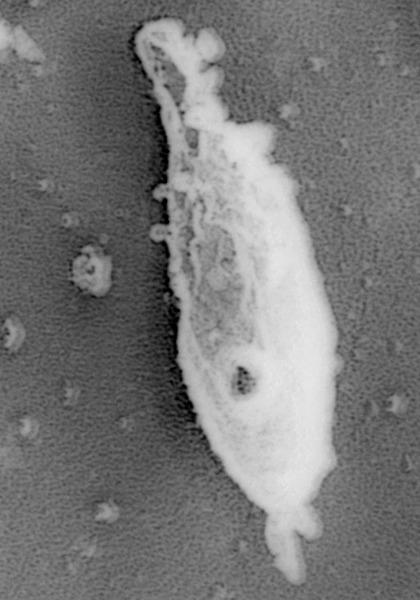 Mycoplasma pneumoniae [IMAGE] | EurekAlert! Science News Releases