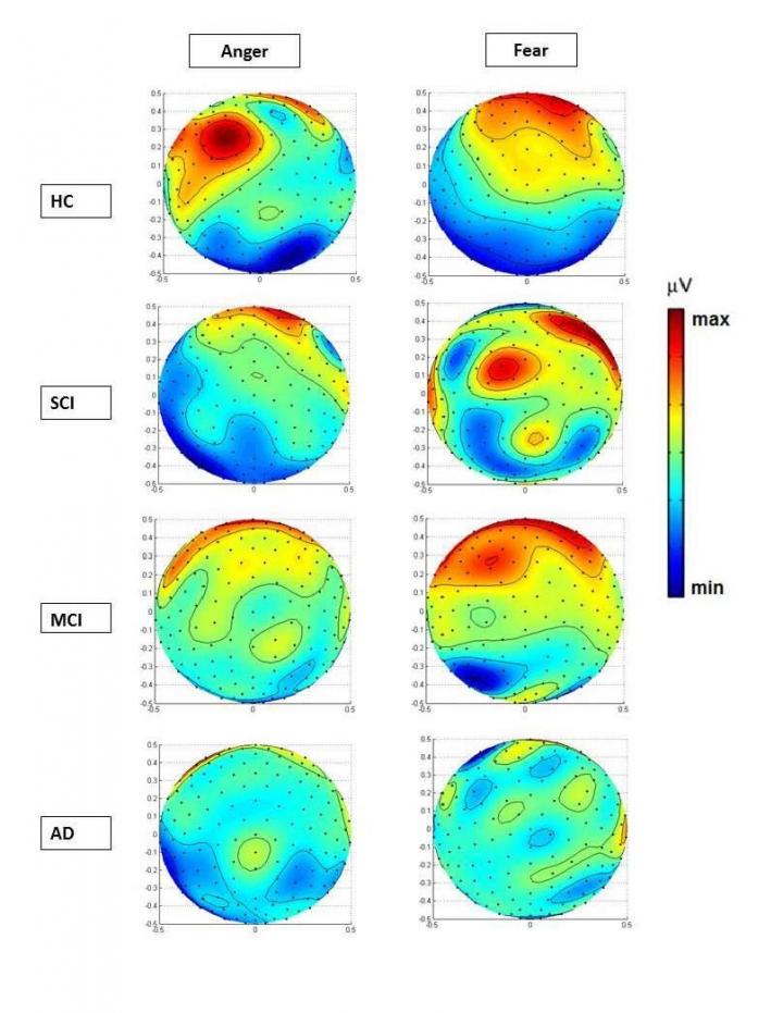 Can a novel high-density EEG approach disenta | EurekAlert!