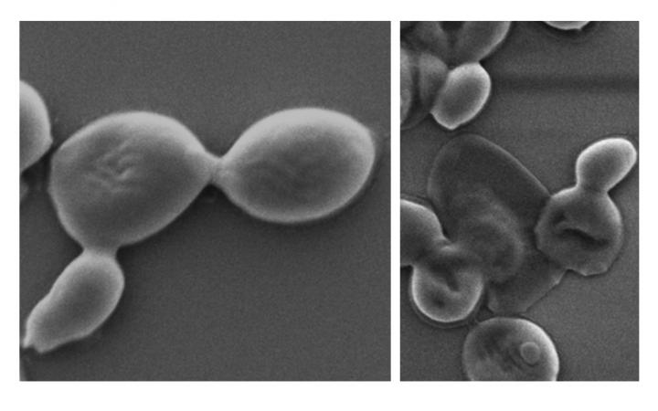 Candida auris (before and afte [IMAGE] | EurekAlert! Science News Releases