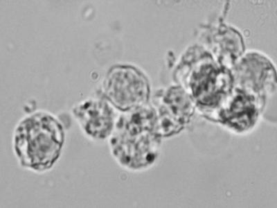 Dying Beta Cells [IMAGE] | EurekAlert! Science News Releases