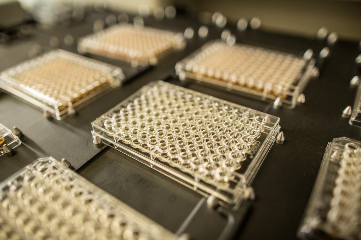 Culture plates in the laborato [IMAGE] | EurekAlert! Science News Releases