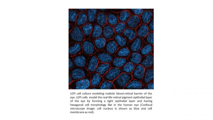 LEPI Cells [IMAGE] | EurekAlert! Science News Releases