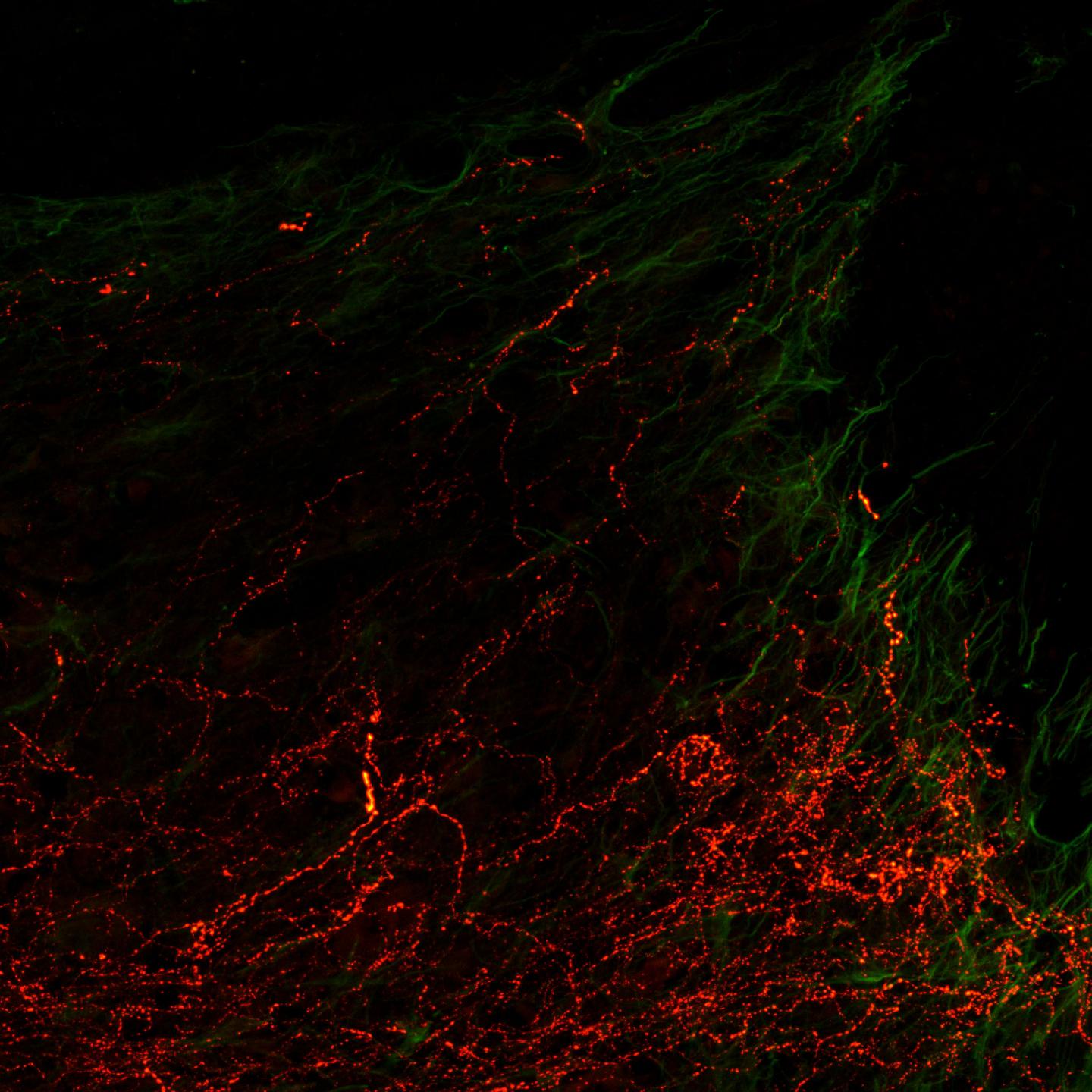 Axons at the Spinal Cord Injur [IMAGE] | EurekAlert! Science News Releases