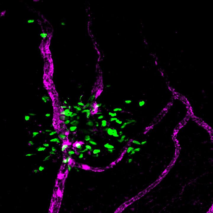 Dormant Cytomegalovirus Reside [IMAGE] | EurekAlert! Science News Releases