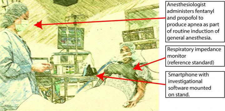 Smartphone Software Detects Early Signs of Op | EurekAlert!