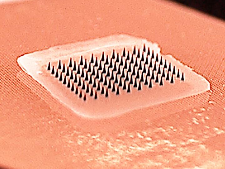 Microneedles [IMAGE] | EurekAlert! Science News Releases