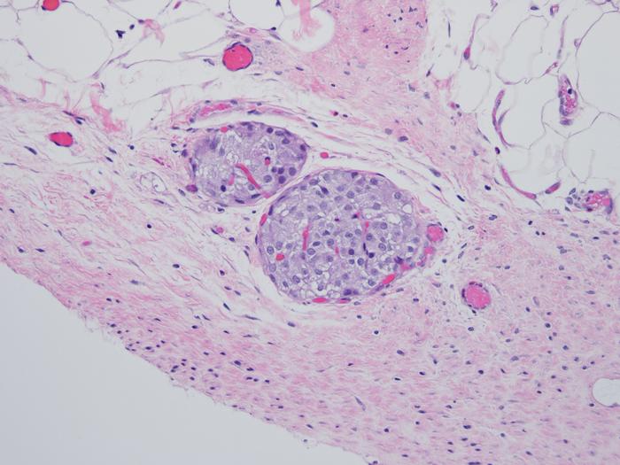 Histological image [IMAGE] | EurekAlert! Science News Releases