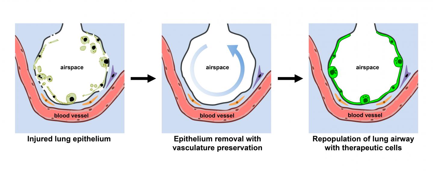 A New Approach Sets Lung Grafts Up for Succes | EurekAlert!
