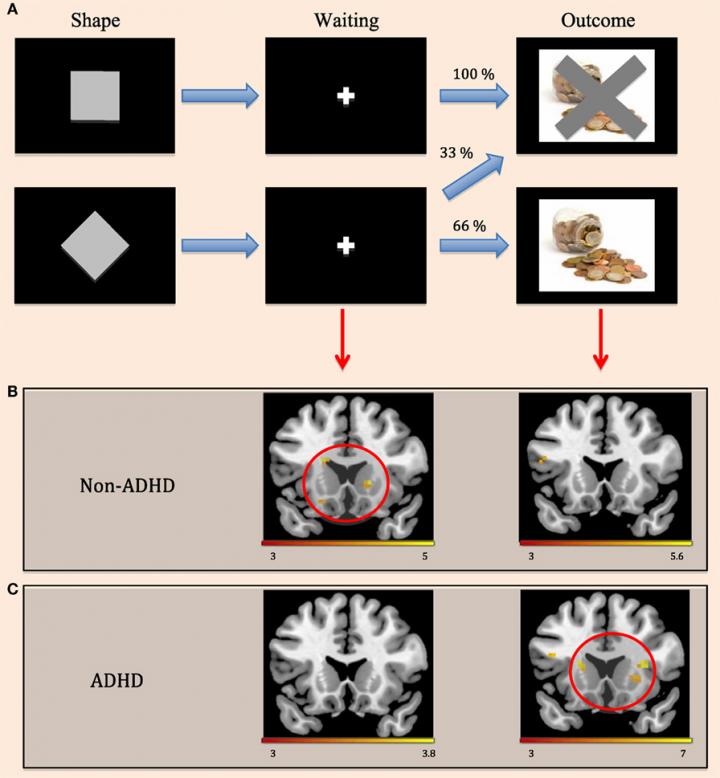 'Are we there yet?' -- explaining ADHD scienc | EurekAlert!