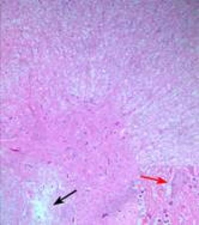Hematoxylin-eosin Staining [IMAGE] | EurekAlert! Science News Releases