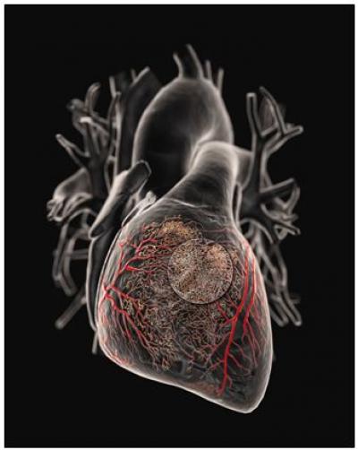 Delivery of gene-therapy for heart disease bo | EurekAlert!