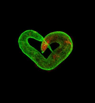 Worm Love [IMAGE] | EurekAlert! Science News Releases