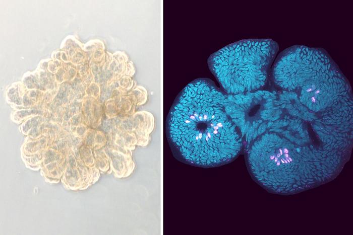 Intestinal organoids [IMAGE] | EurekAlert! Science News Releases
