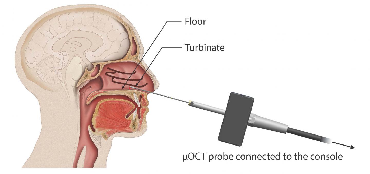 Minimally Invasive Probe Provi [IMAGE] | EurekAlert! Science News Releases