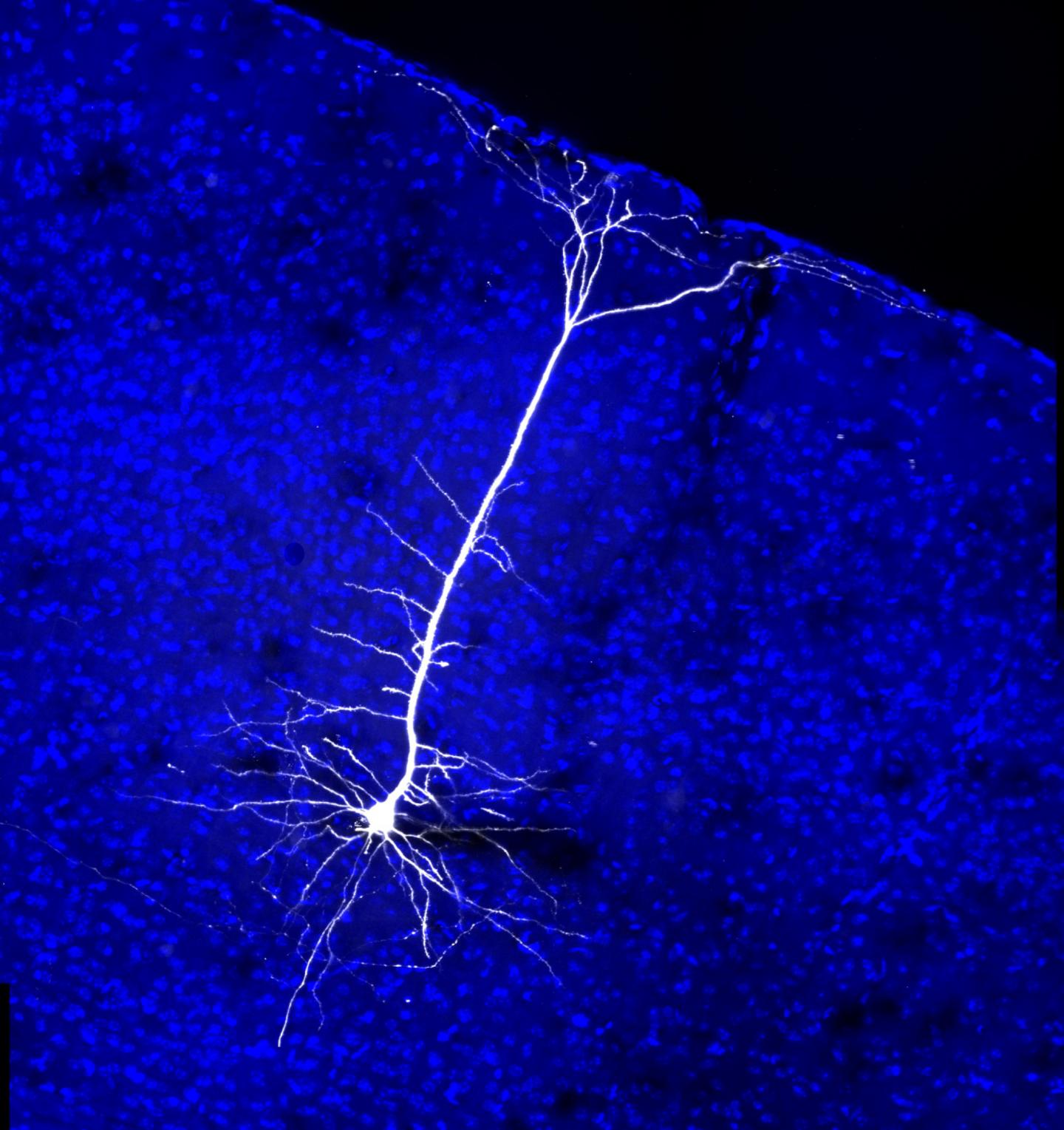 Neuron Projection from the Vis [IMAGE] | EurekAlert! Science News Releases