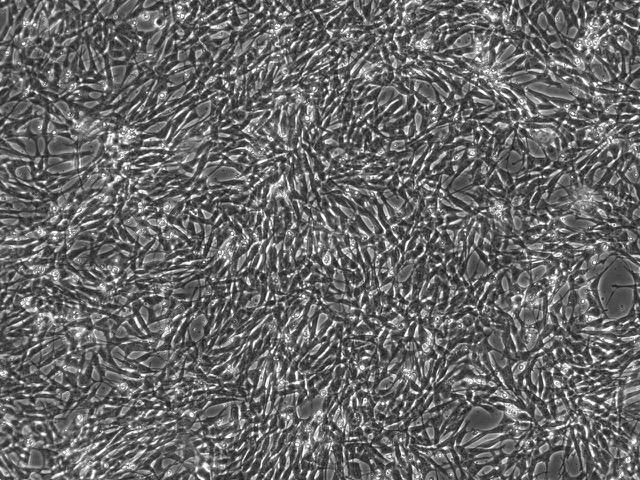 Endothelial Cells [IMAGE] | EurekAlert! Science News Releases
