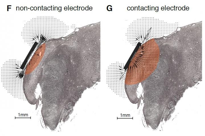 Soft Implants for Deafness Better Interface w | EurekAlert!