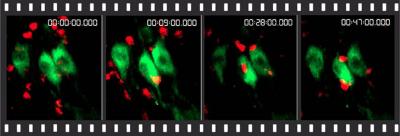 New Findings on Multiple Scler [IMAGE] | EurekAlert! Science News Releases