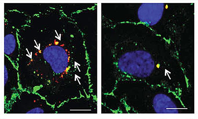 CD59 and Statins [IMAGE] | EurekAlert! Science News Releases