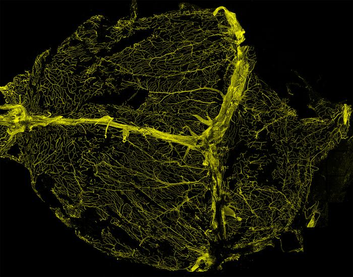 Blood Vessels of the Dura Mate [IMAGE] | EurekAlert! Science News Releases