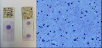 1940s blood samples reveal historical spread | EurekAlert!