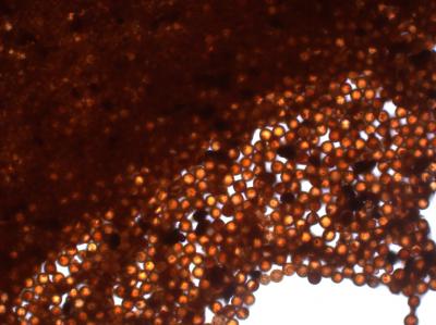 What's in your microcapsule? Tattoo ink -- an | EurekAlert!
