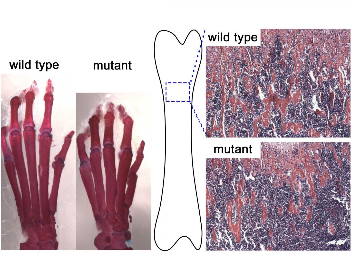 Key regulator of bone development identified | EurekAlert!