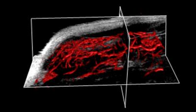 Acoustic Angiography Image [IMAGE] | EurekAlert! Science News Releases