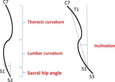 Spinal Posture [IMAGE] | EurekAlert! Science News Releases