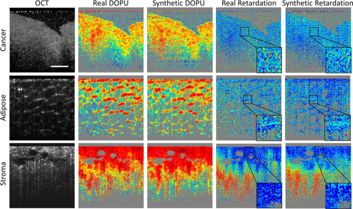 Computational and real PS-OCT [IMAGE] | EurekAlert! Science News Releases