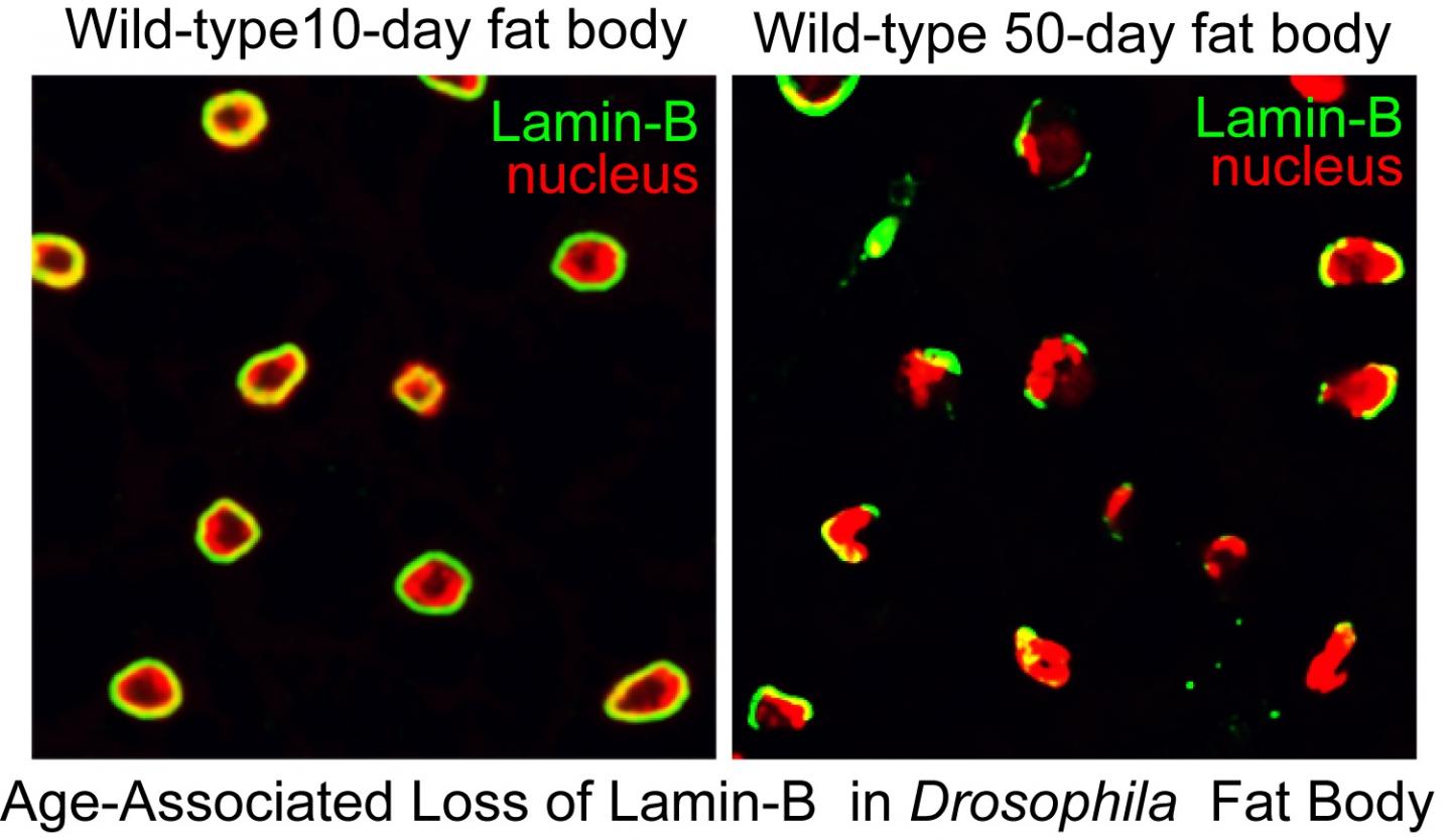 Aging Fruit Fly Fat Bodies [IMAGE] | EurekAlert! Science News Releases