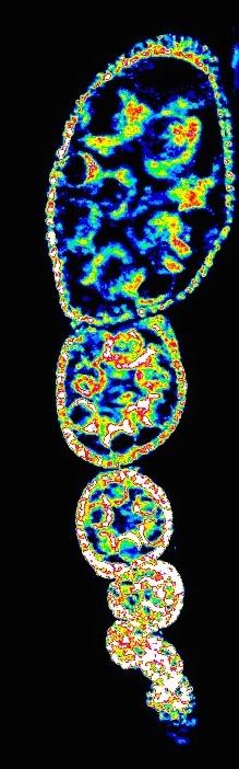 Ovariole [IMAGE] | EurekAlert! Science News Releases