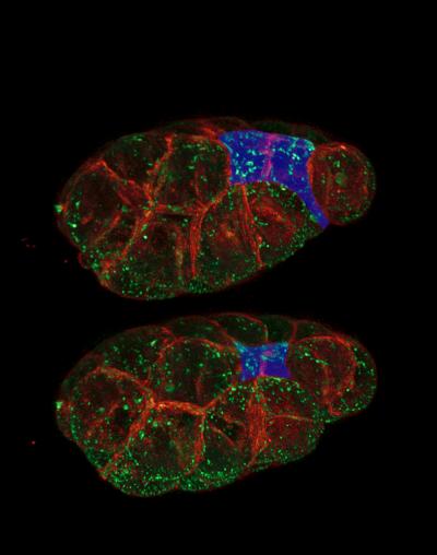 Under the Microscope, Shape-Shifting Cells (2 | EurekAlert!