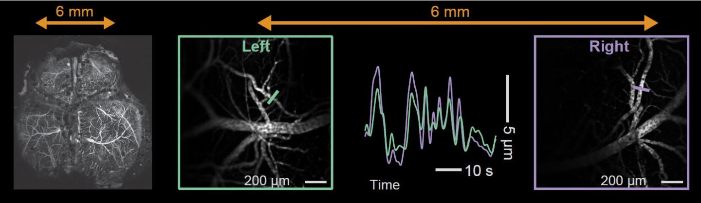 Brain Tracking [IMAGE] | EurekAlert! Science News Releases