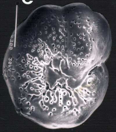 Benthic Foram [IMAGE] | EurekAlert! Science News Releases