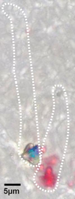 Human cones [IMAGE] | EurekAlert! Science News Releases